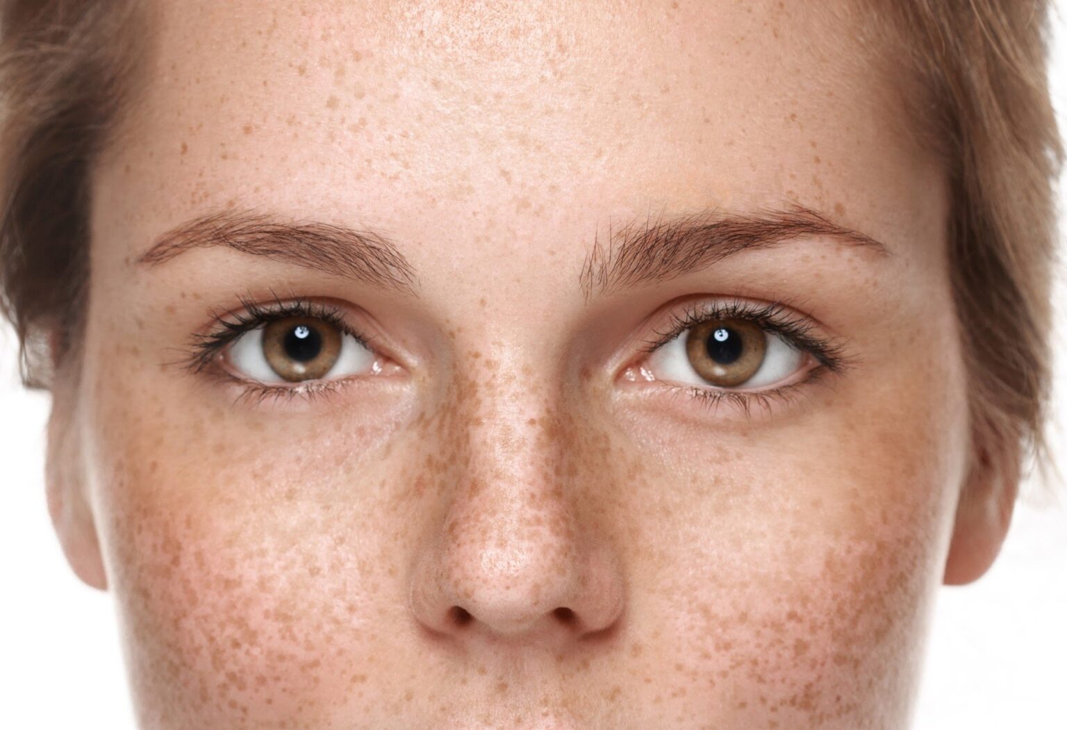 Tratamientos para manchas oscuras: ¿Qué funciona realmente?